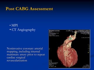 Cardiovascular Imaging | PPT
