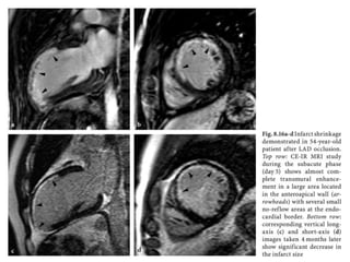 cardiovascular_imaging.ppt
