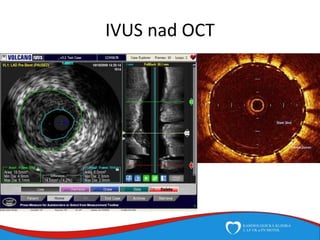 cardiovascular_imaging.ppt