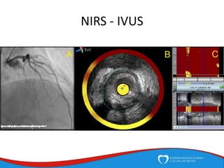 cardiovascular_imaging.ppt