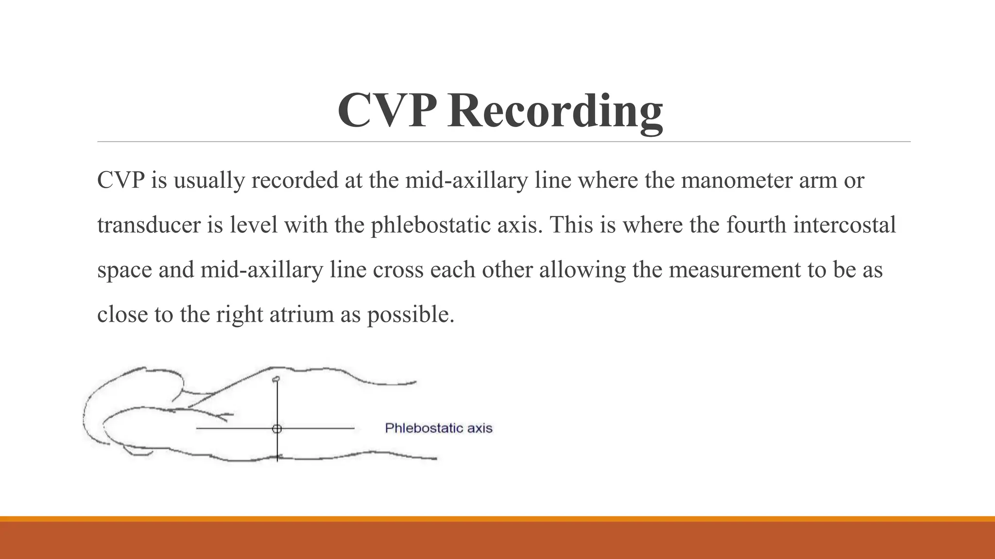 cardiovascular monitoring in anaesthsia .pptx