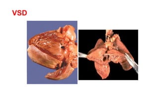 CARDIOVASCULAR PATHOLOGY.pptx