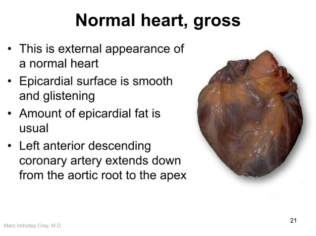 Cardiovascular Pathology Case-based_Gross and Microscopic | PDF