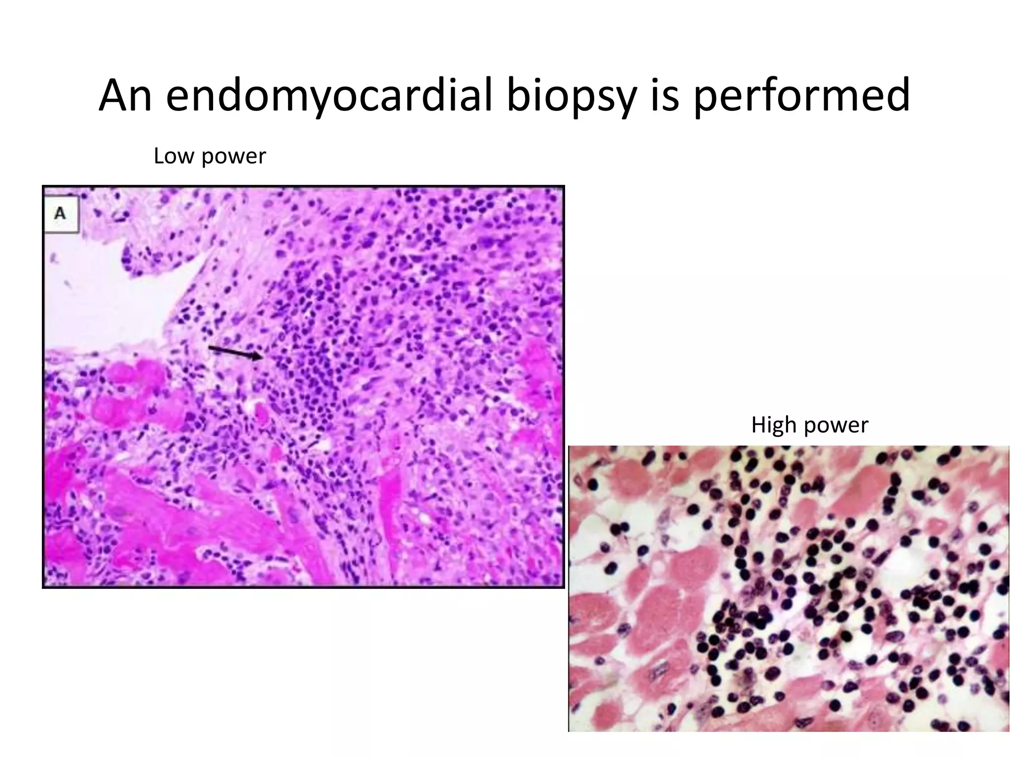 cardiovascular pathology i.ppt