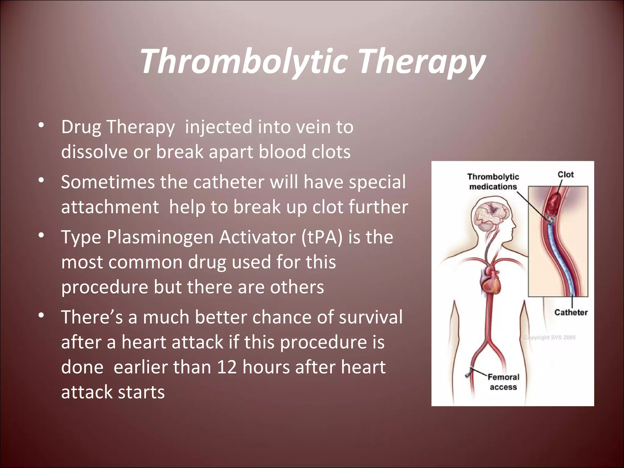 Cardiovascular procedures | PPT