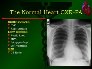 Cardiovascular Radiology Acquired Disease.ppt