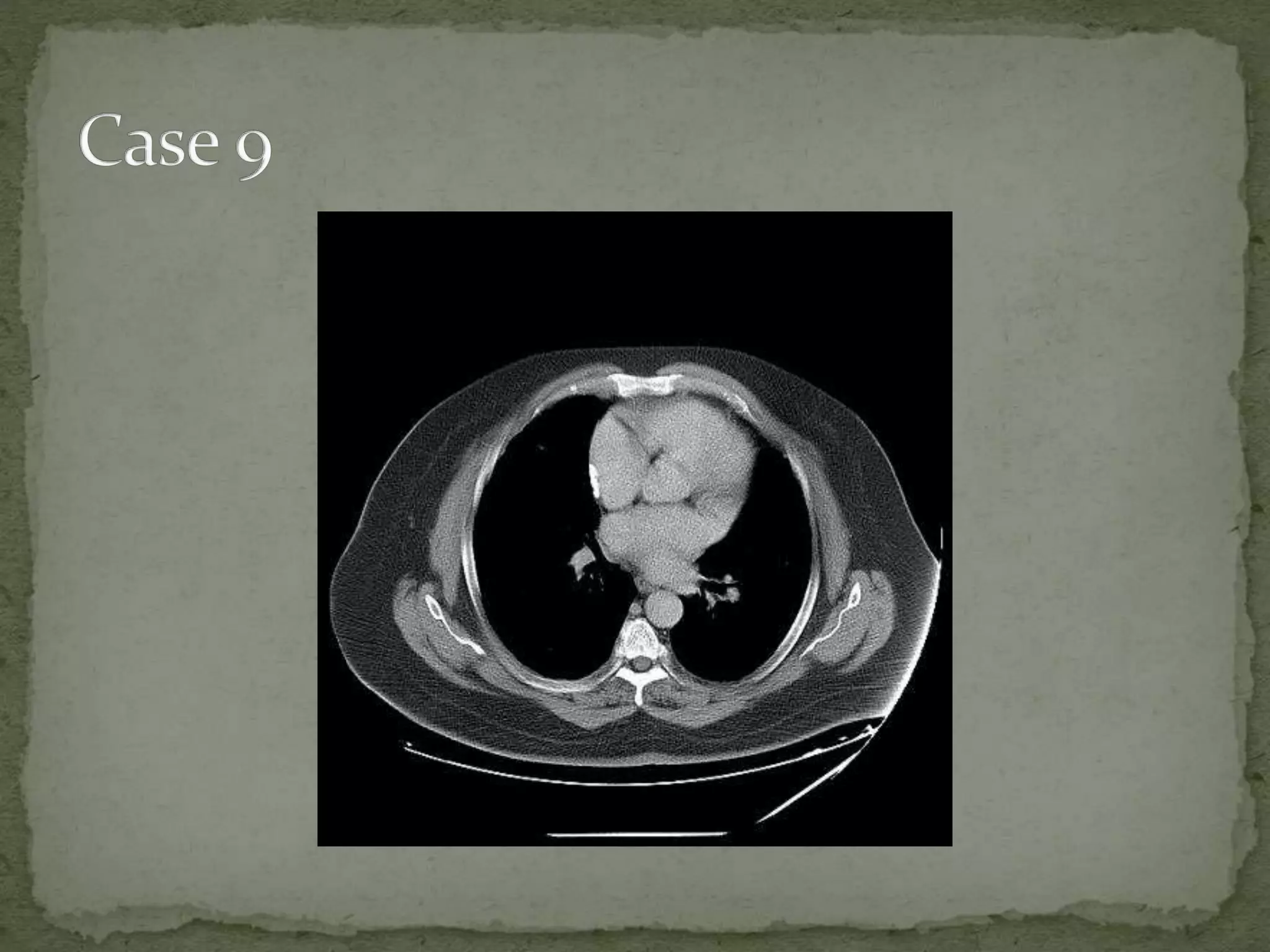 Cardiovascular spotting TEST | PPTX