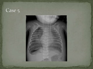 Cardiovascular spotting TEST | PPTX