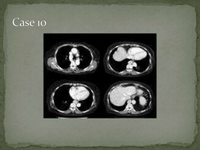 Cardiovascular spotting TEST | PPTX