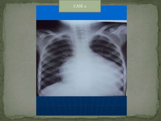 Cardiovascular spotting TEST | PPTX