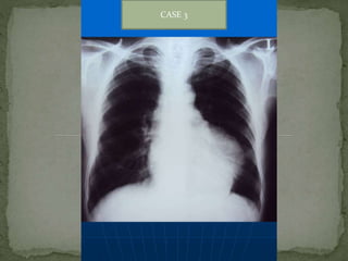 Cardiovascular spotting TEST | PPTX