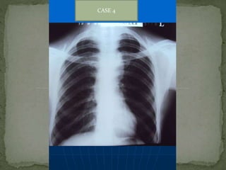 Cardiovascular spotting TEST | PPTX