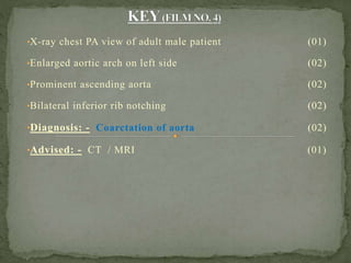 Cardiovascular spotting TEST | PPTX