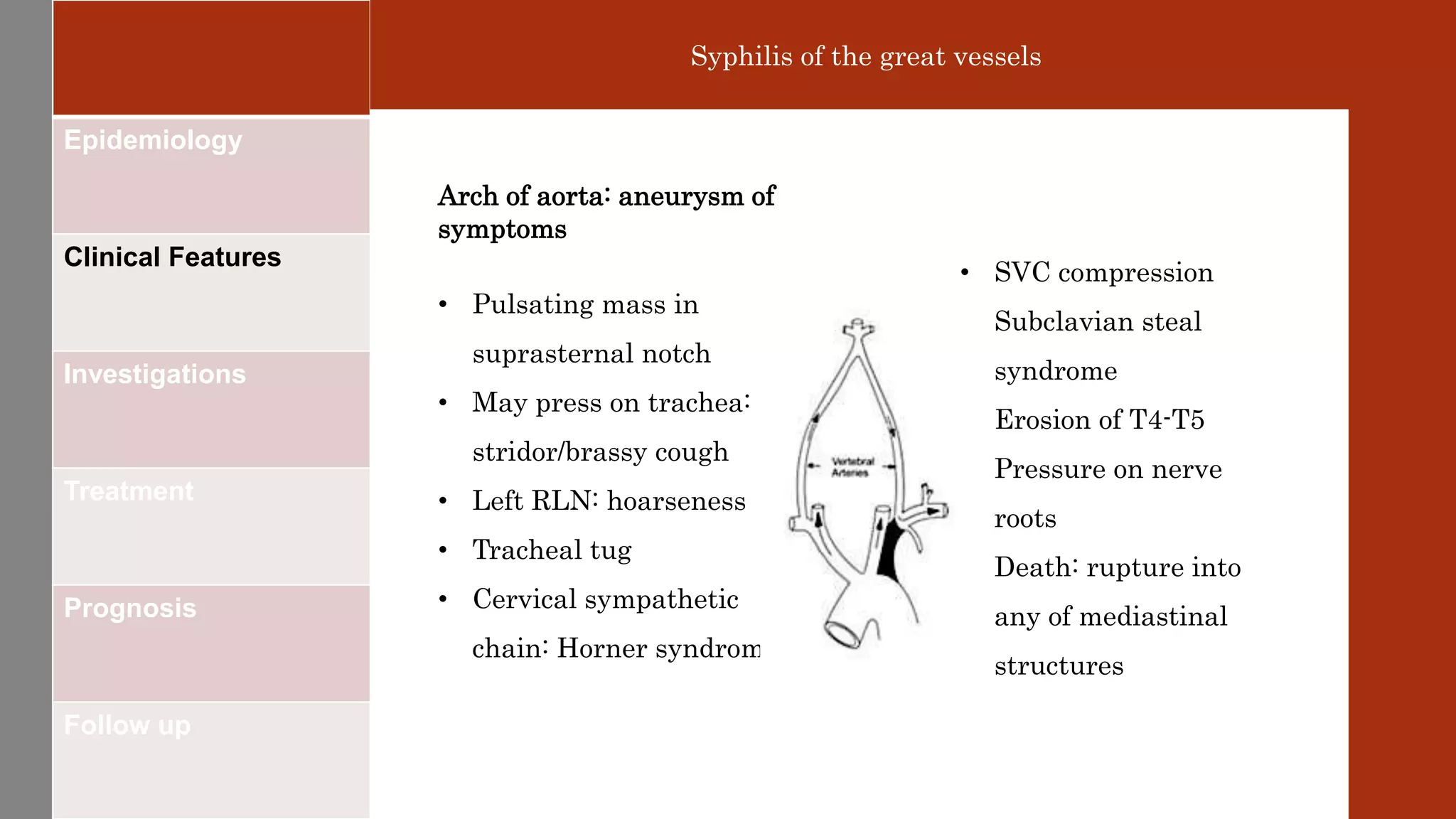 Cardiovascular syphilis | PPTX