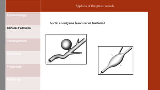 Cardiovascular syphilis | PPTX | Infectious Diseases | Diseases and ...