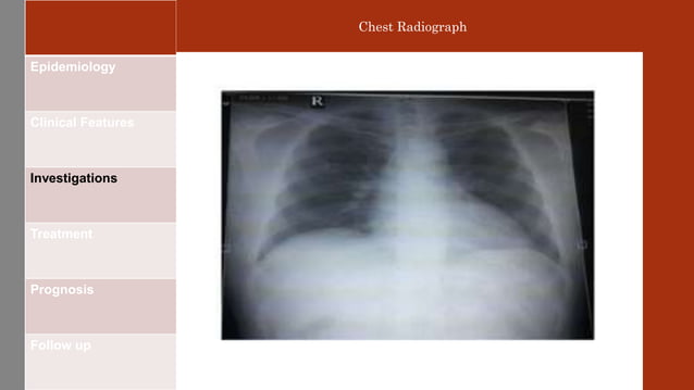 Cardiovascular syphilis | PPTX | Infectious Diseases | Diseases and ...