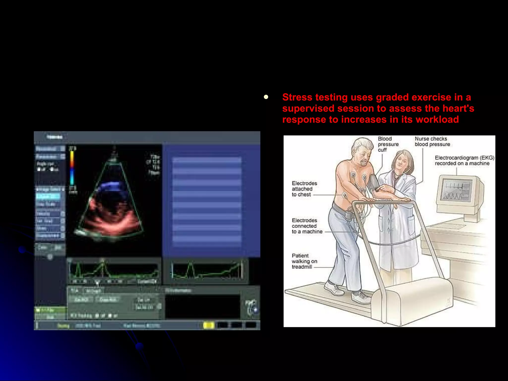 Cardiovascular System | PPT