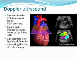 Cardiovascular system/ diagnostic tests and procedures | PPTX