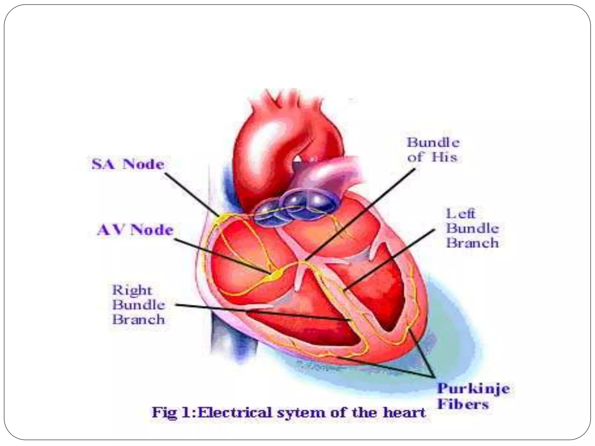 Cardiovascular system arrhythmia Disorders of heart Rate and rhythm and ...