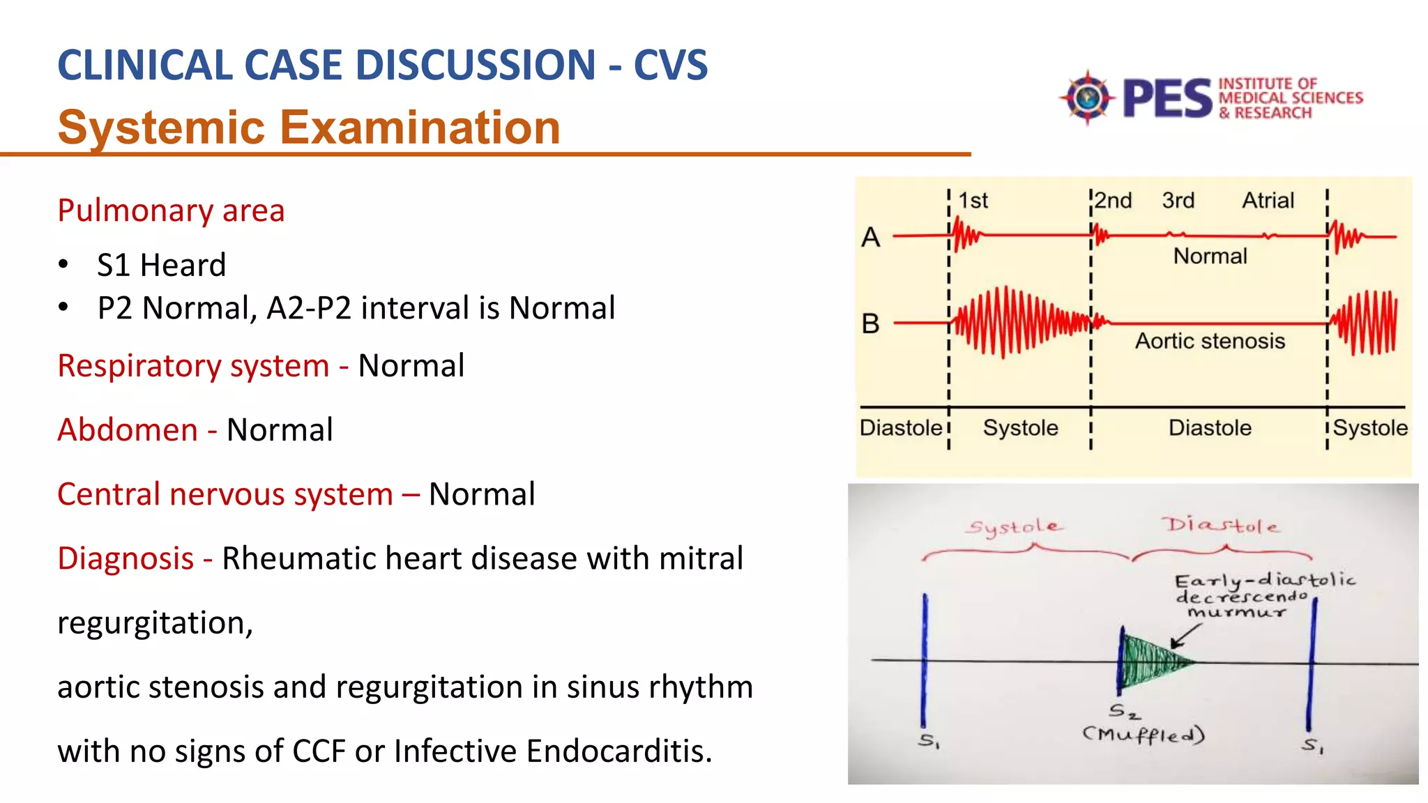 Cardiovascular system (cvs) | PPT