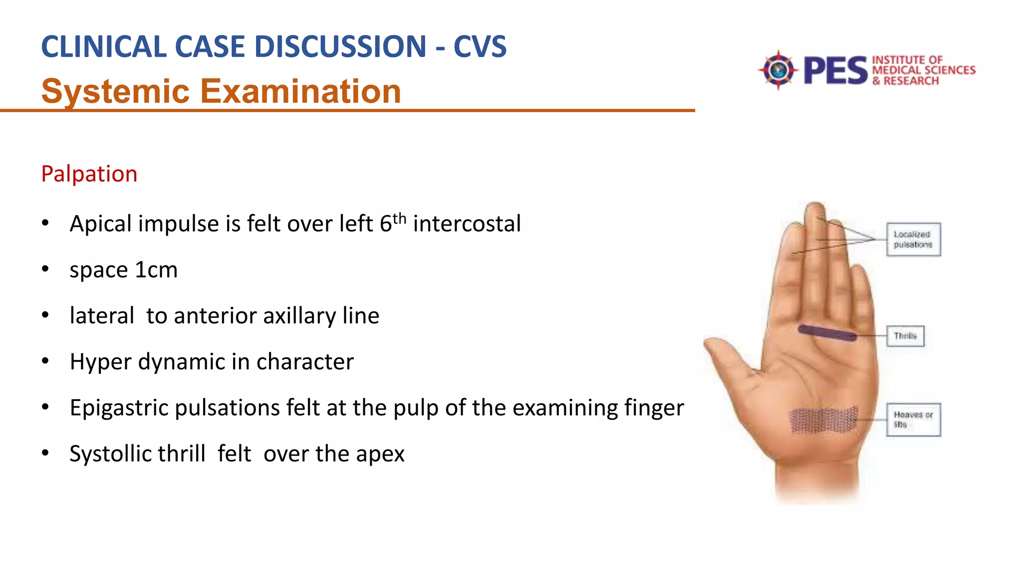 Cardiovascular system (cvs) | PPT