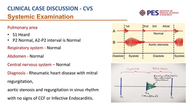 Cardiovascular system (cvs) | PPT | Lung and Respiratory Health ...