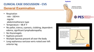 Cardiovascular system (cvs) | PPT