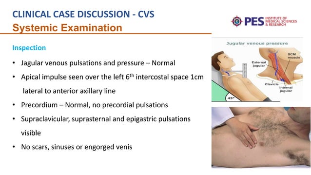 Cardiovascular system (cvs) | PPT | Lung and Respiratory Health ...