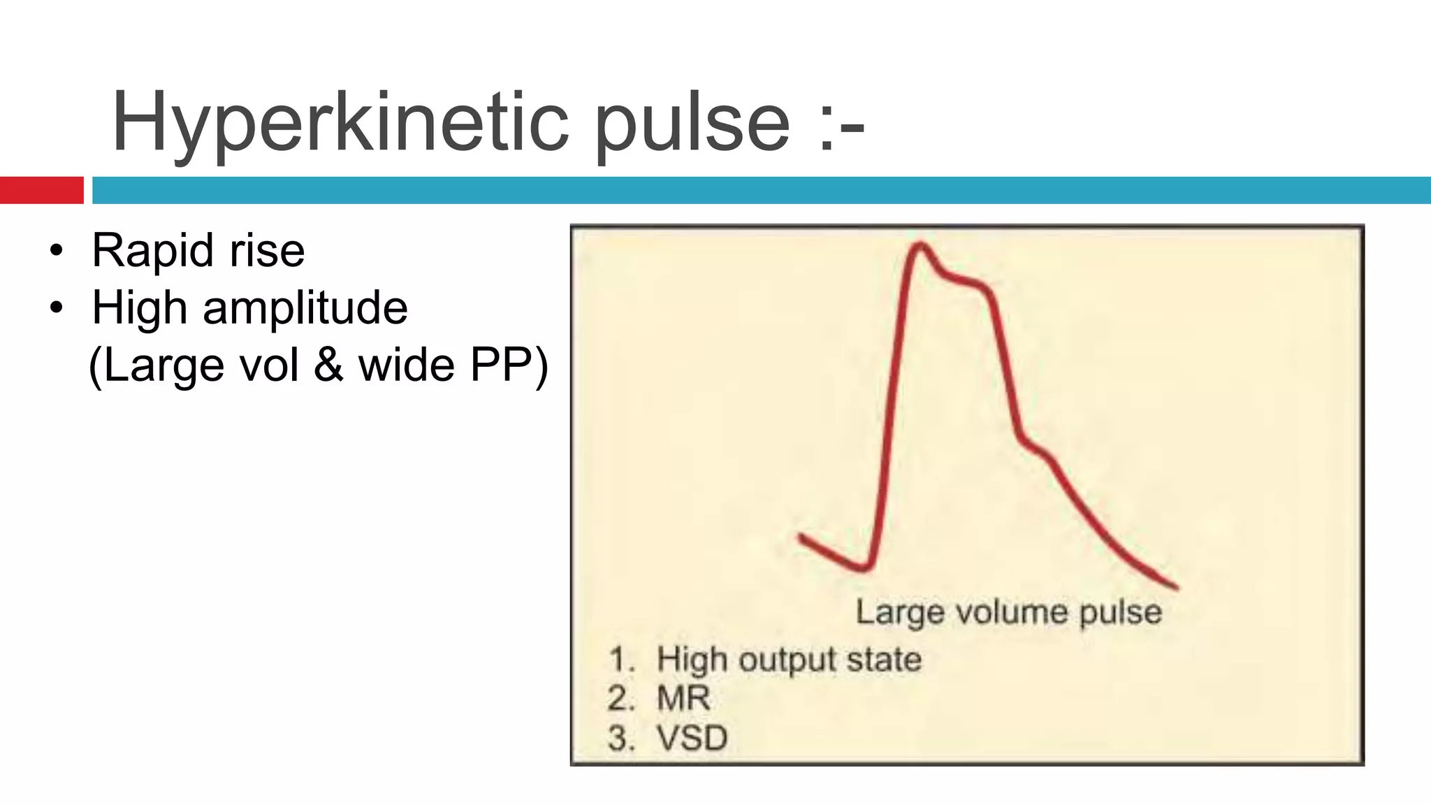 Cardiovascular system examination | PPTX