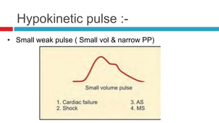 Cardiovascular system examination | PPTX