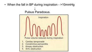 Cardiovascular system examination | PPTX