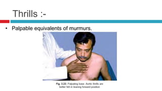 Cardiovascular system examination | PPTX
