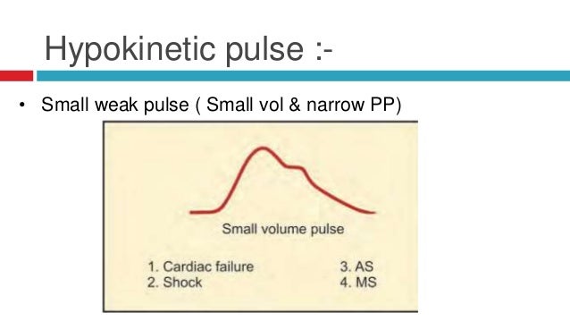 Cardiovascular system examination