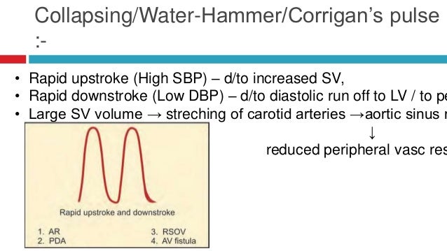 Cardiovascular system examination