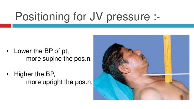 Cardiovascular system examination