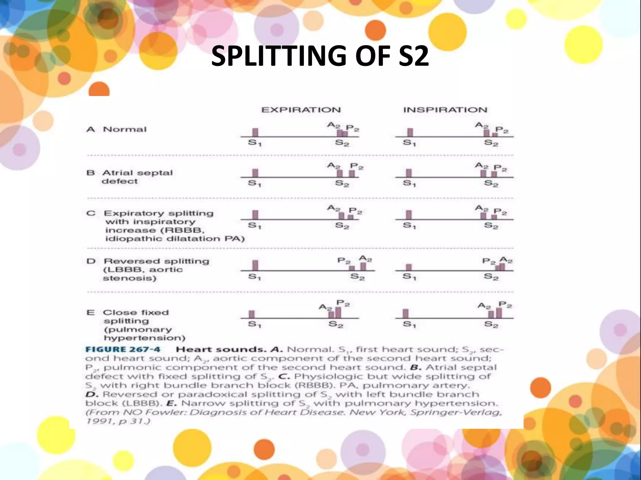 Cardiovascular system examination , auscultation and its ...