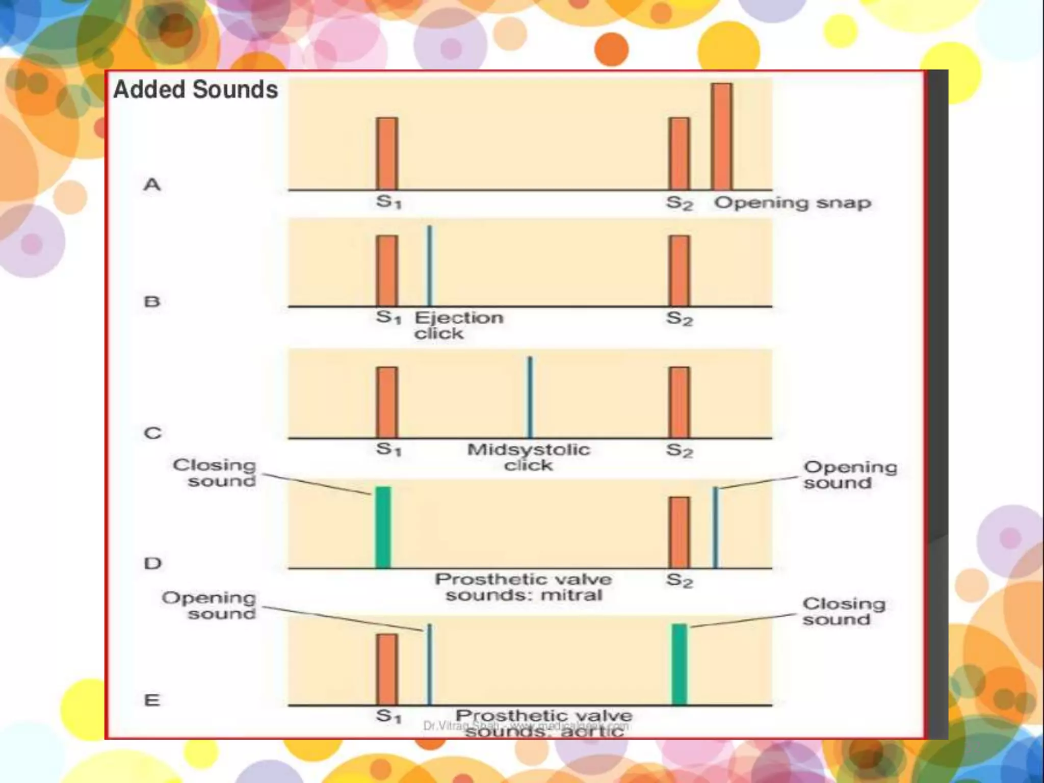 Cardiovascular system examination , auscultation and its ...