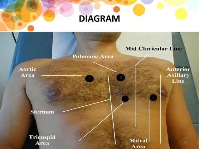 Cardiovascular system examination , auscultation and its ...