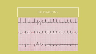 Cardiovascular system history taking | PPTX