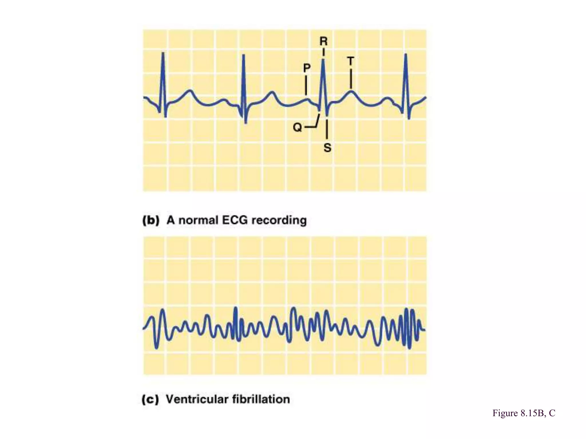 Cardiovascular System Marieb.ppt
