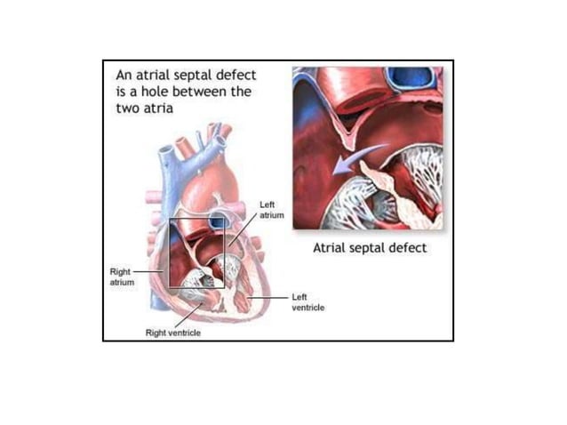 Cardiovascular System Marieb.ppt | Heart and Cardiovascular Diseases ...