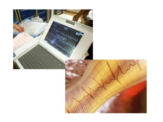 Cardiovascular System Marieb.ppt | Heart and Cardiovascular Diseases ...