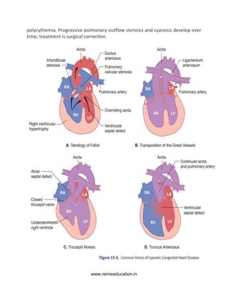 Cardiovascular system pathology | PDF