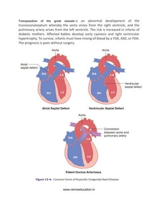 Cardiovascular system pathology | PDF