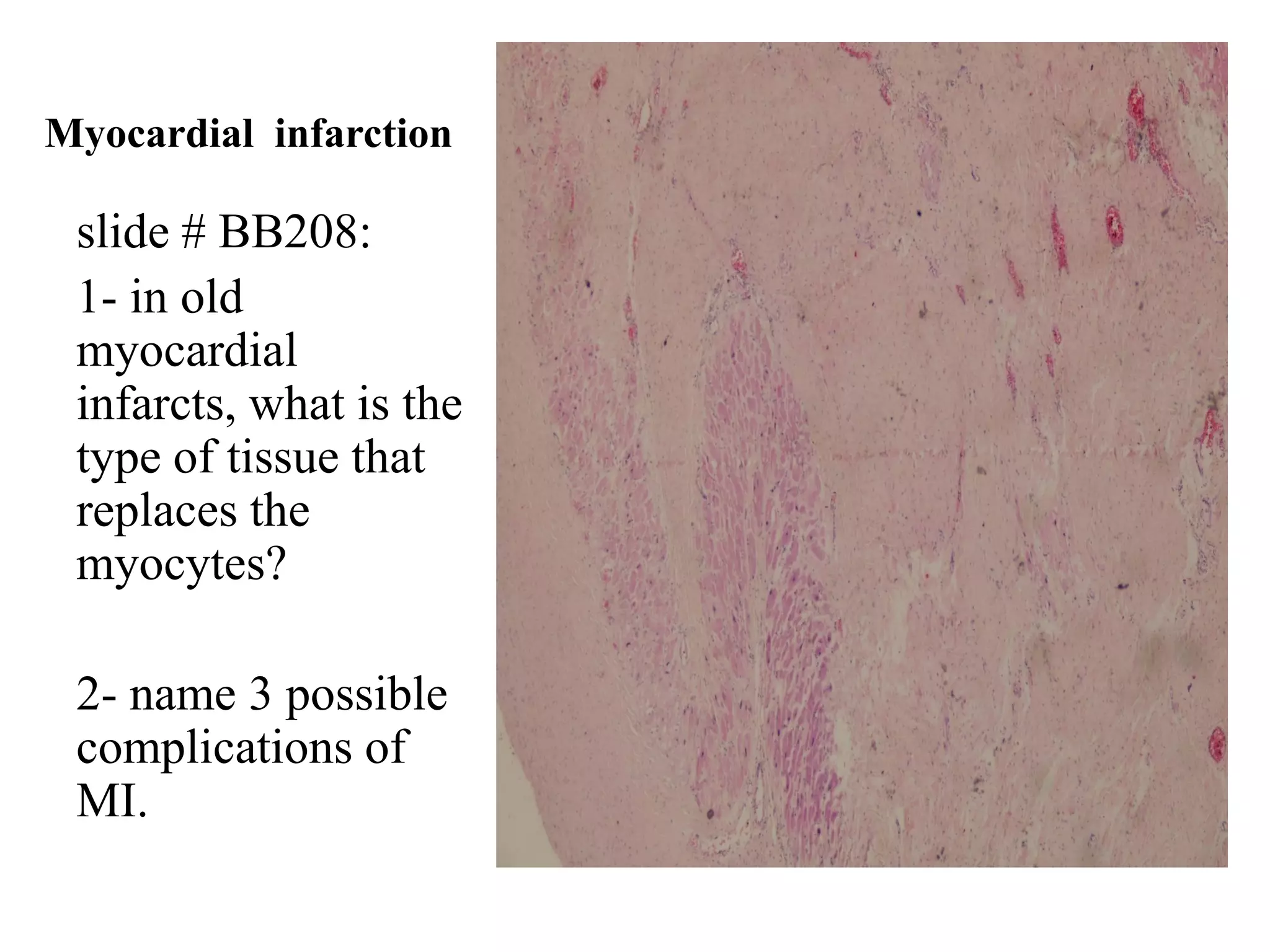 Cardiovascular system pathology lab | PDF