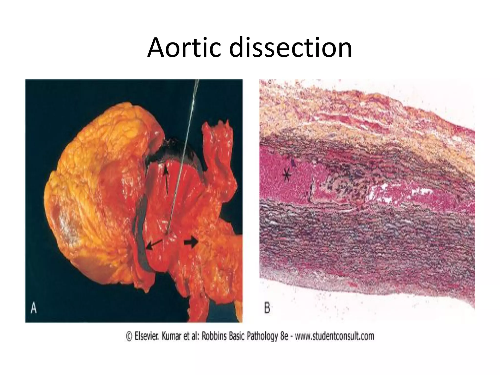 Cardiovascular system pathology lab | PDF