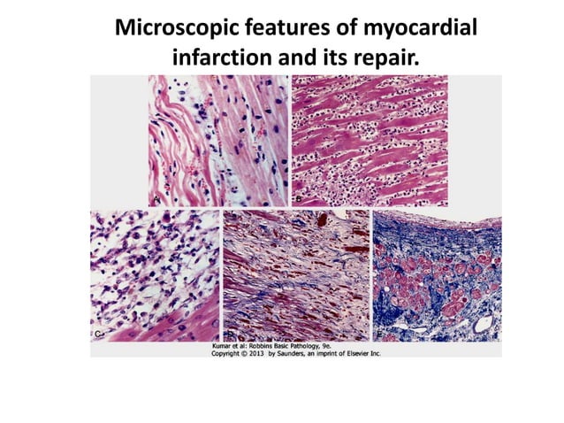 Cardiovascular system pathology lab | PDF | Heart and Cardiovascular ...