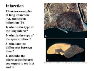 Cardiovascular system pathology lab | PDF