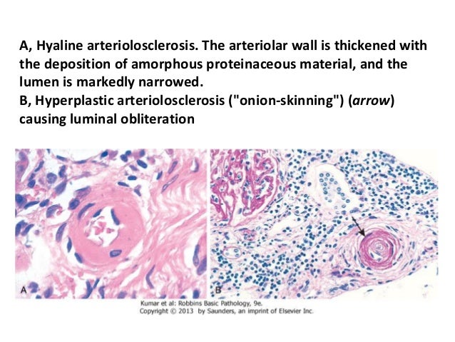 Cardiovascular system pathology lab