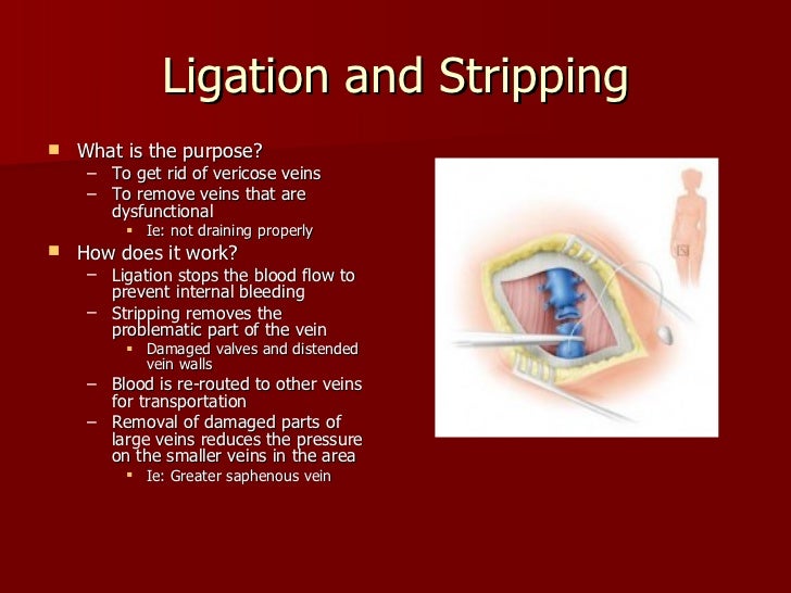 Cardiovascular system procedures